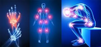 Todo sobre la artralgia - React Spain Magazine